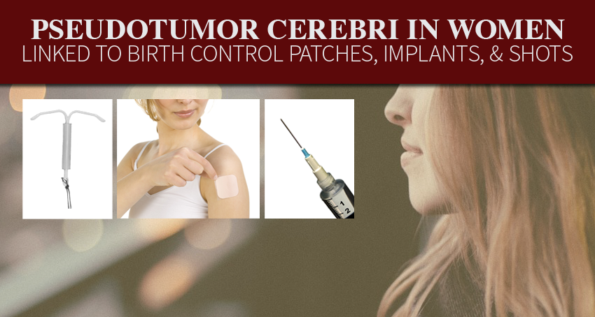 Pseudotumor Cerebri - Monroe Law Group